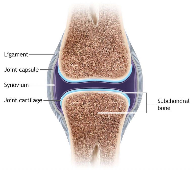 Subchondroplasty / SCP for Bone Marrow Lesions
