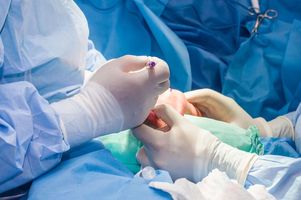 WALANT Hand Surgery at Premier Ortho in Southern California