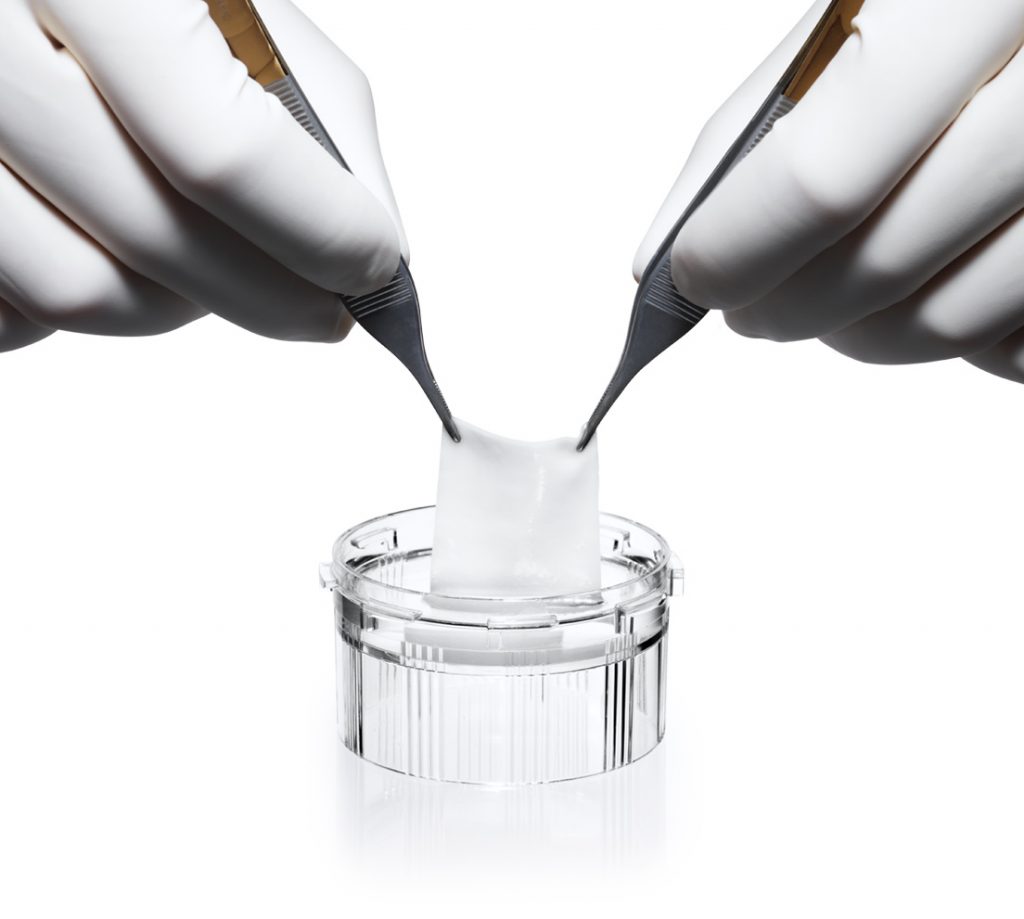 Autologous Chondrocyte Implantation (ACI) for the Knee, Pomona, CA